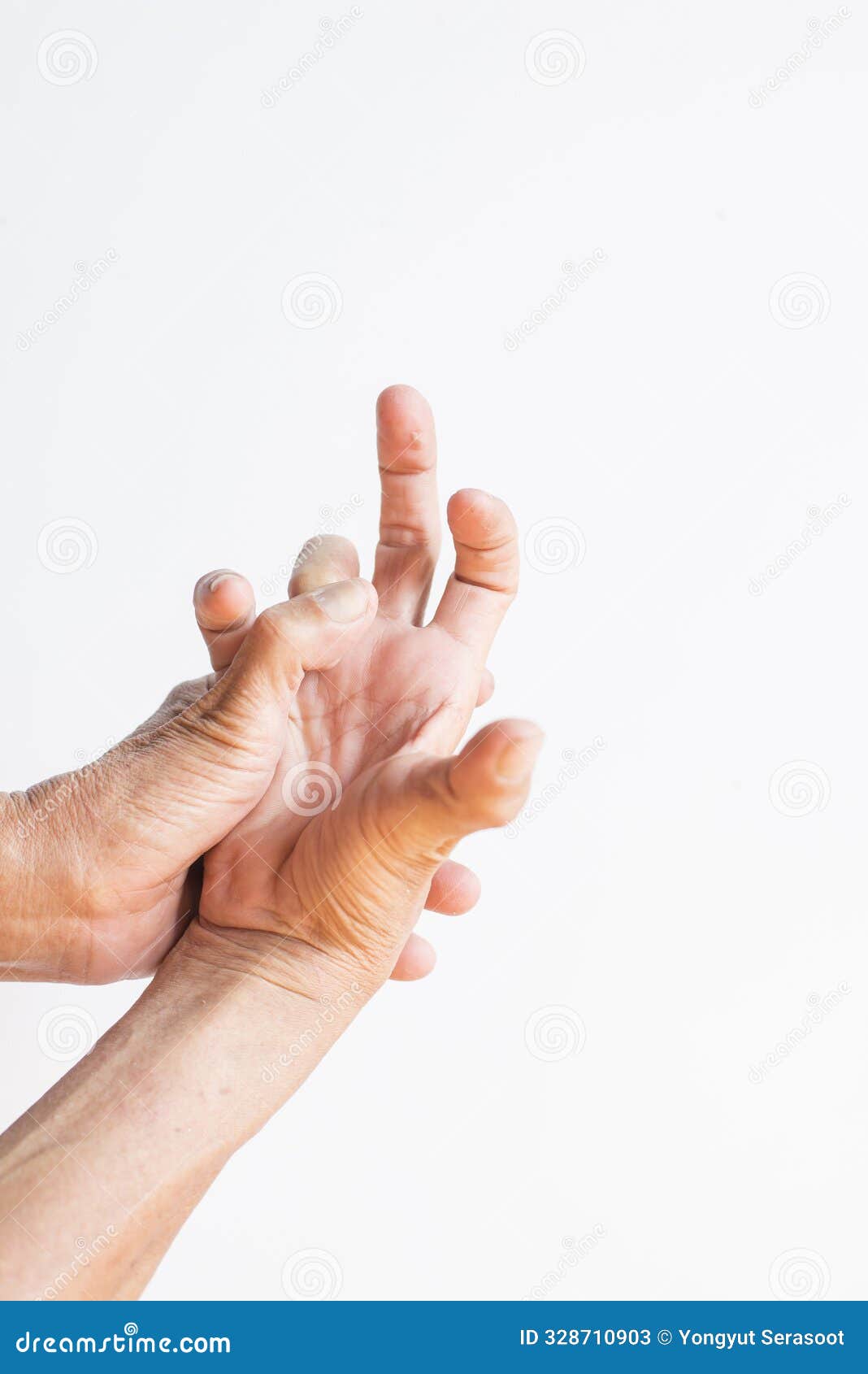 Hands with Problems of Deterioration of the Bones of the Fingers Stock ...