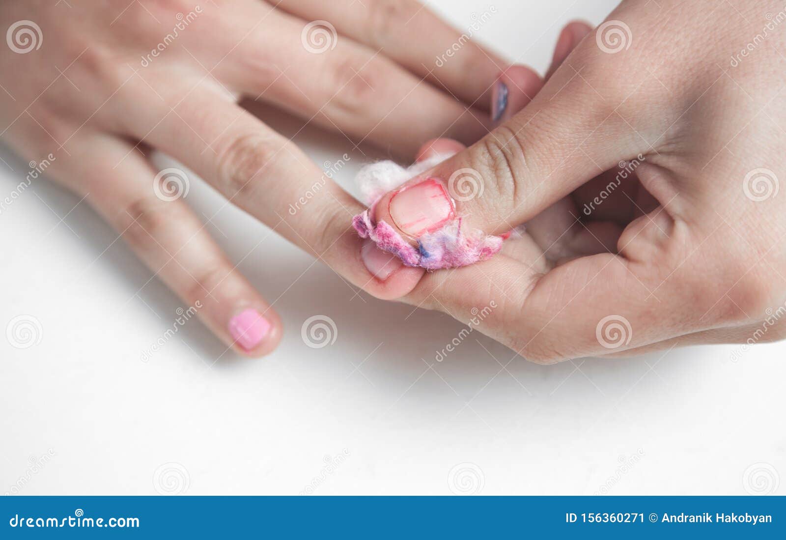Hands Remove the Manicure on Fingernails Stock Image - Image of ...