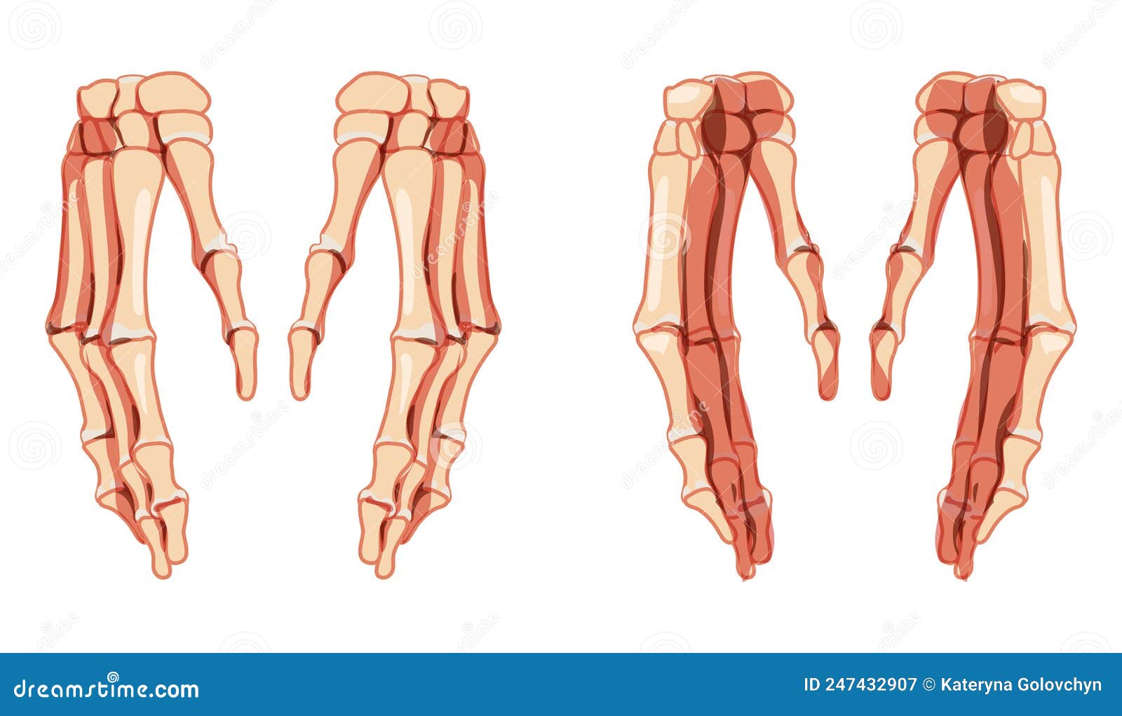 Hands Skeleton Human Front Back View. Set Of Carpals, Wrist ...
