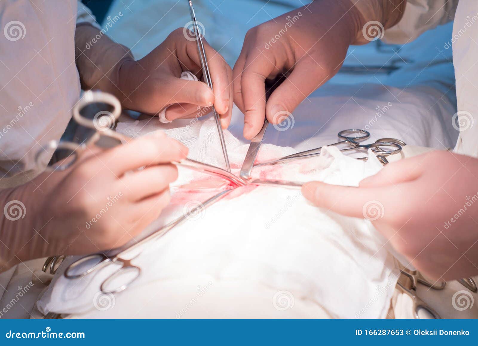 Hands of Surgeon and Assistant, Close-up, during Surgery Stock Image ...