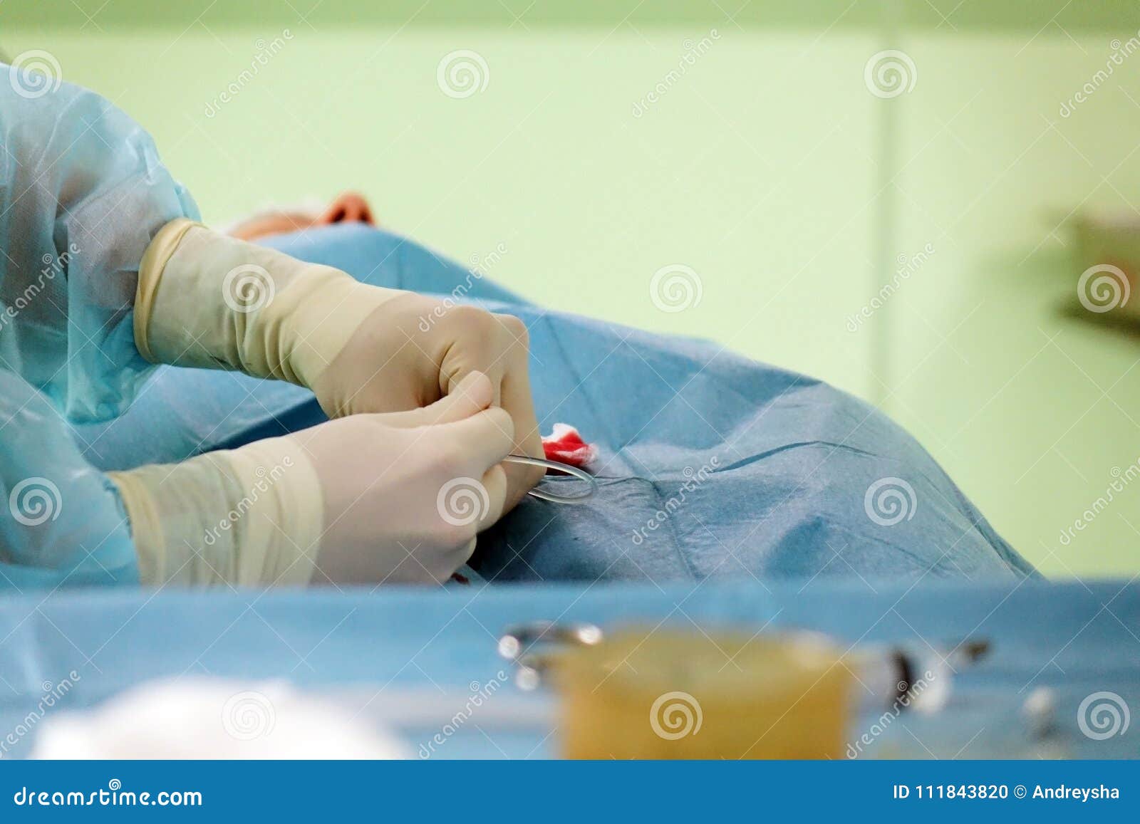The hands of a surgeon. stock photo. Image of cardiac - 111843820