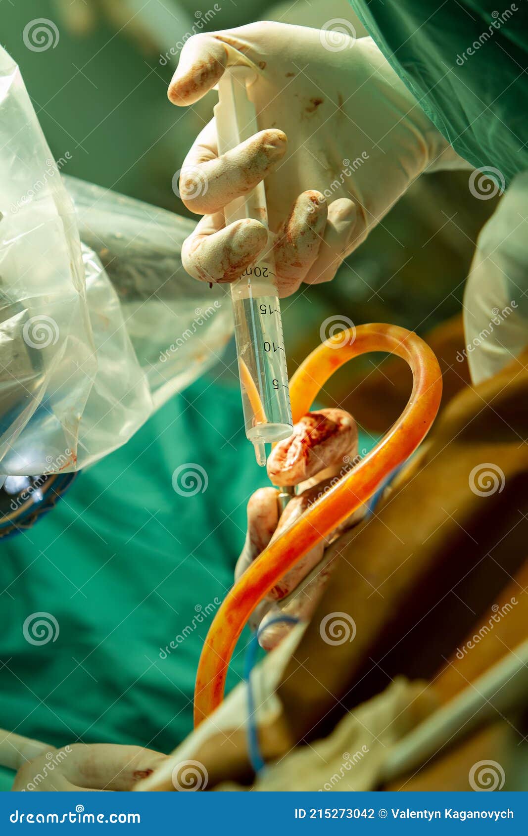The Hands of the Surgeon`s Assistant with a Syringe Stock Photo - Image ...