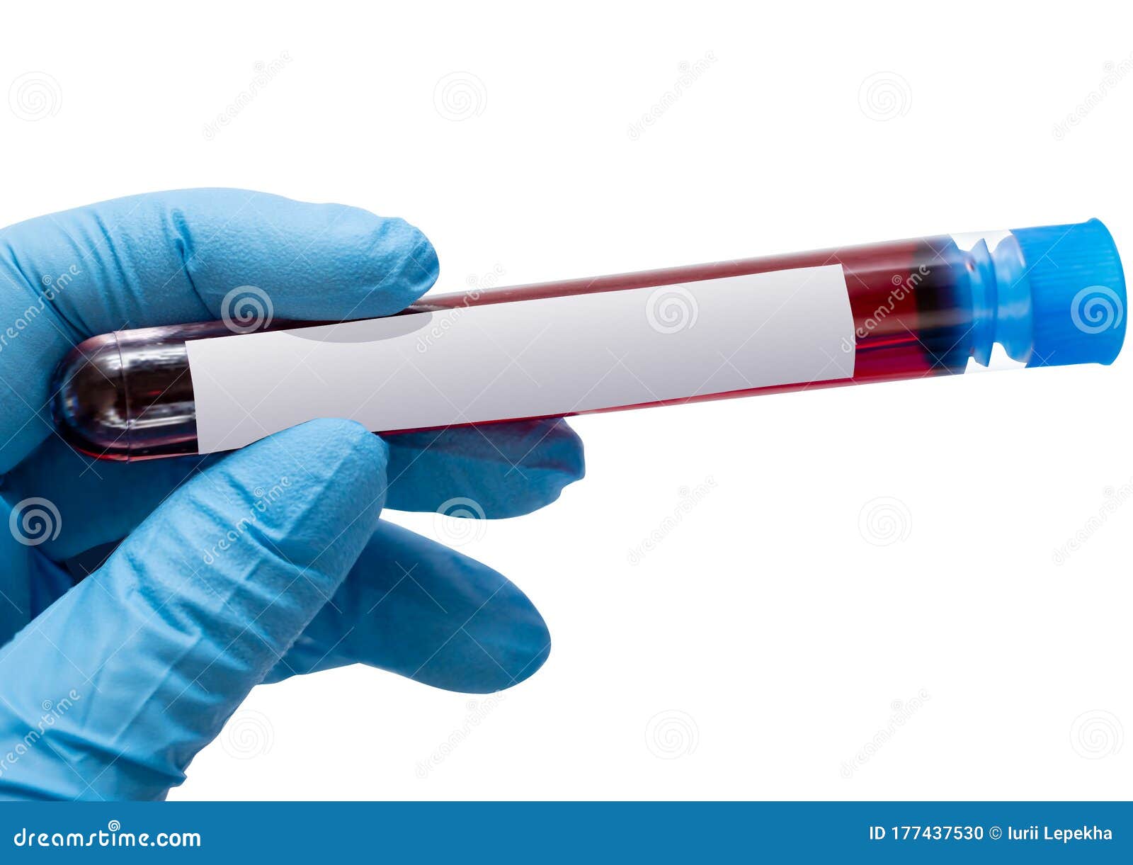 In the Hands of the Test Tubes with Blood Ready for Testing. Blood for ...