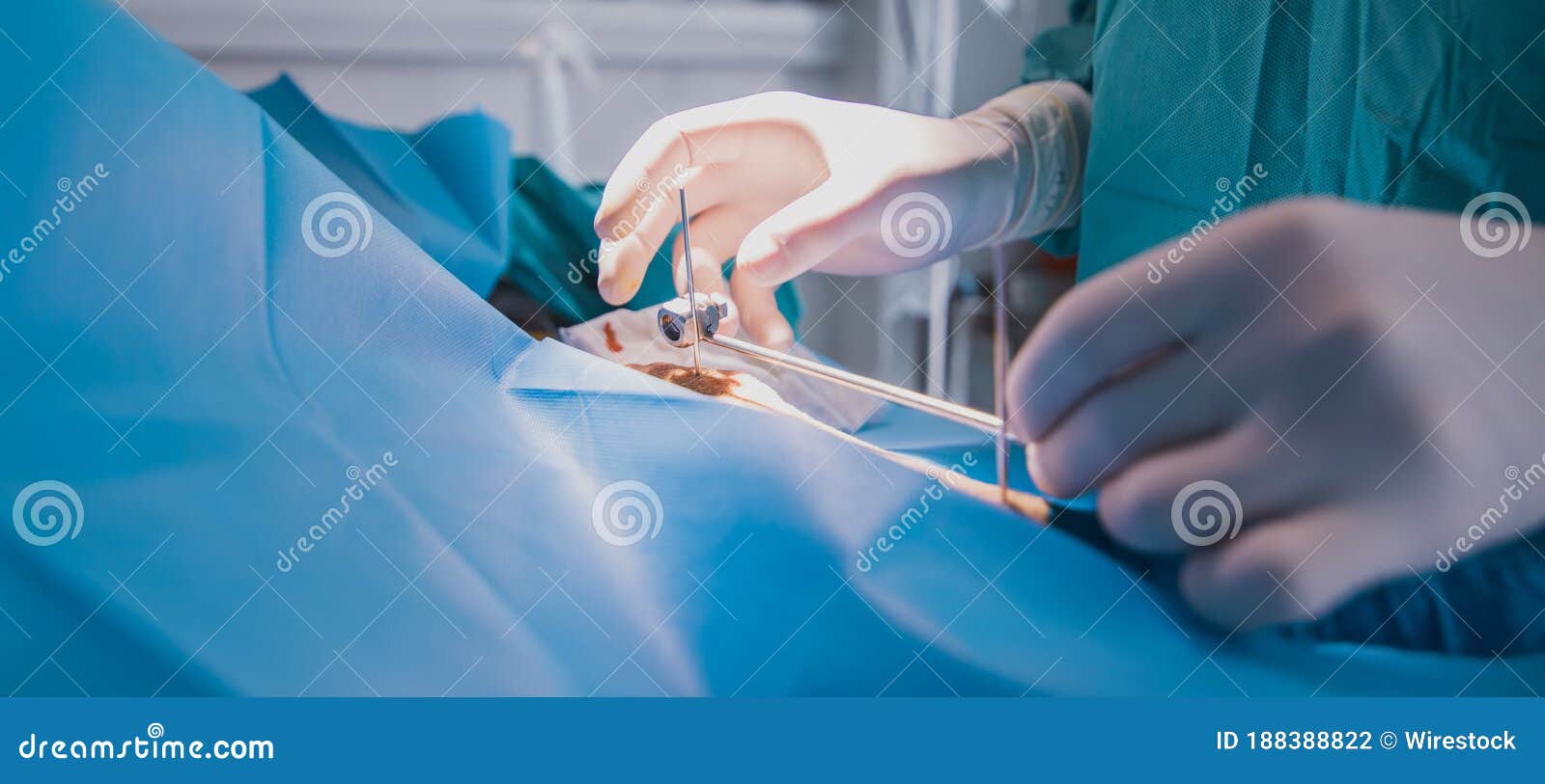 Hands of a Veterinarian Working on a Traumatology Stock Photo - Image ...