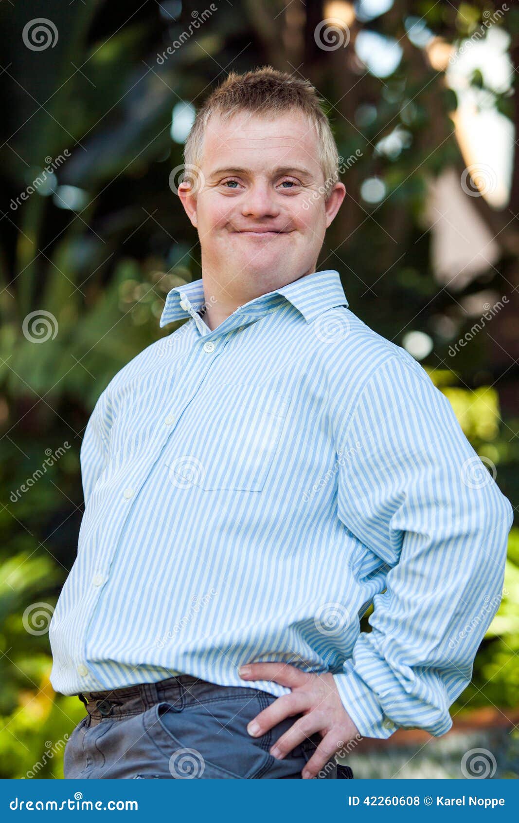 Handsome Handicapped Boy Posing at Camera. Stock Photo - Image of face ...