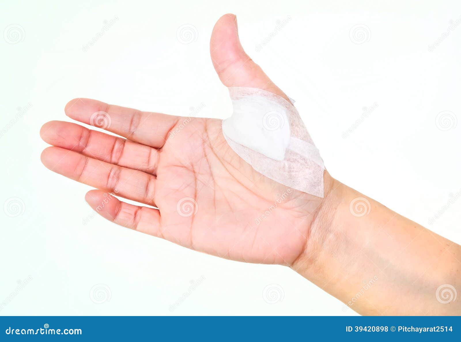 Handverletzung stockfoto. Bild von verletzung, hilfsmittel - 39420898