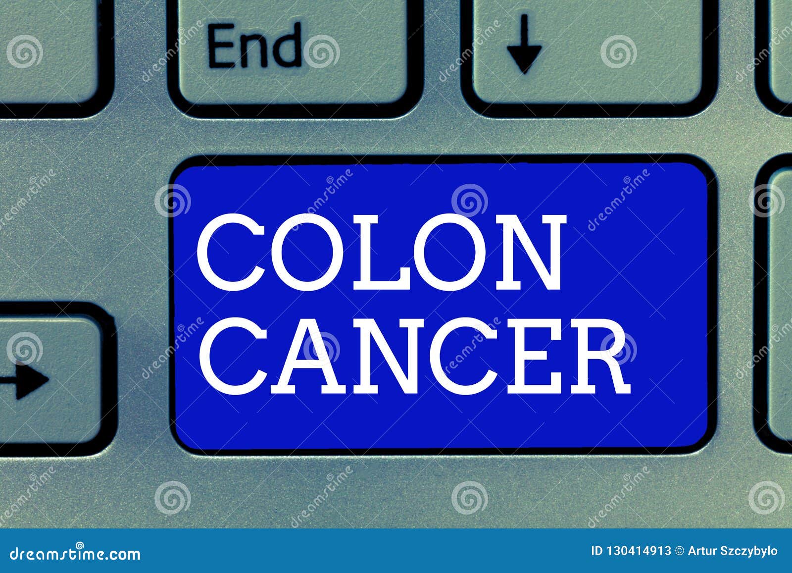 Handwriting Text Colon Cancer. Concept Meaning Cancer that Forms in the ...