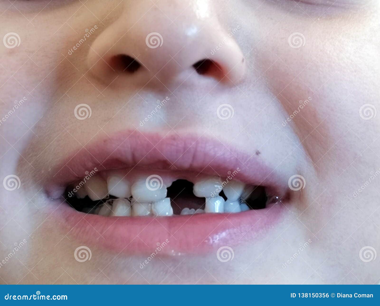 Child Proud of Missing Front Tooth Stock Photo - Image of change ...