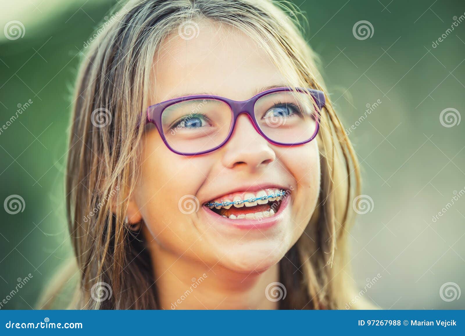 Happy Smiling Girl With Dental Braces And Glasses Young Cute Caucasian