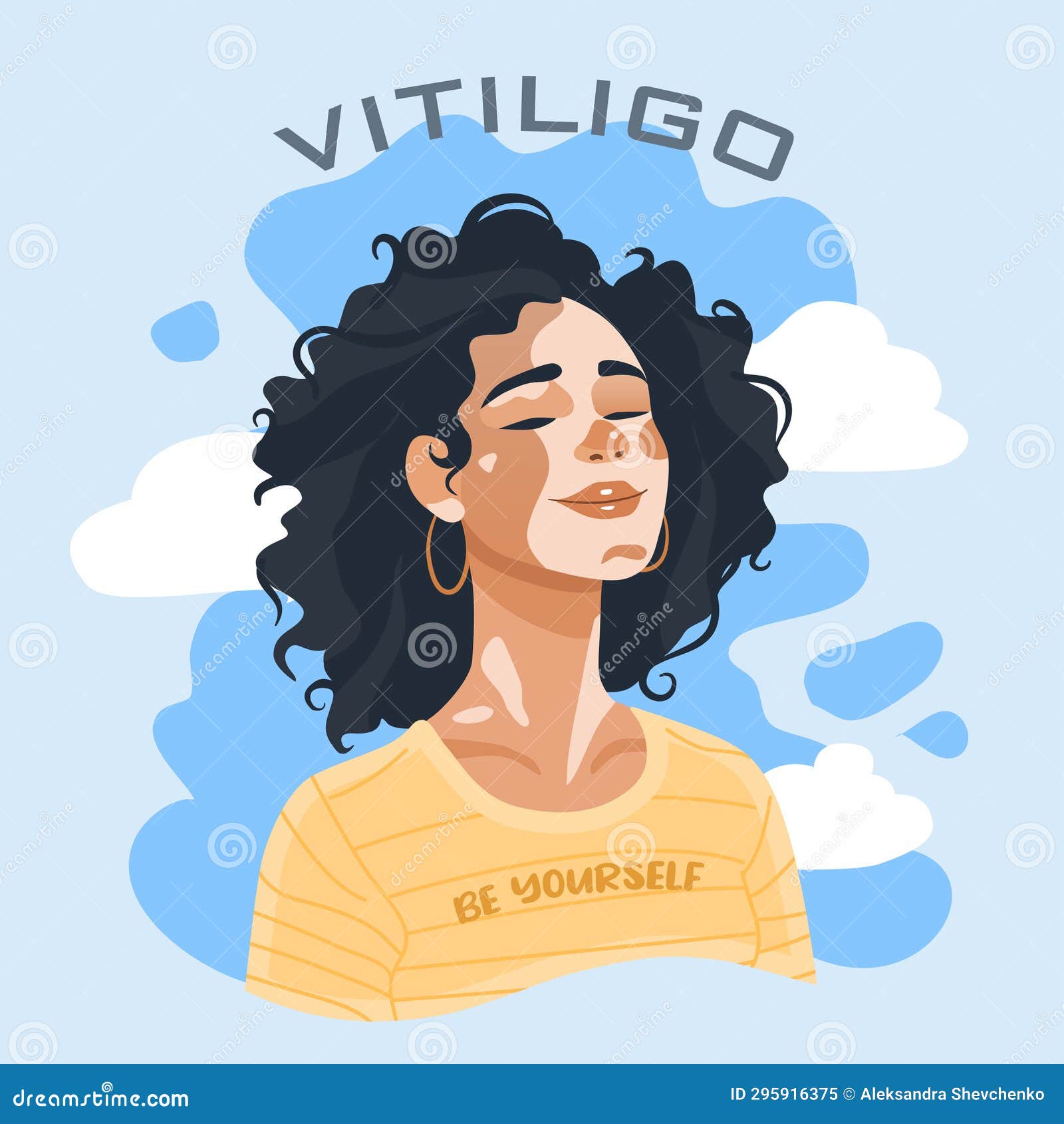 Happy Woman With Vitiligo Skin Problems World Vitiligo Day Stock