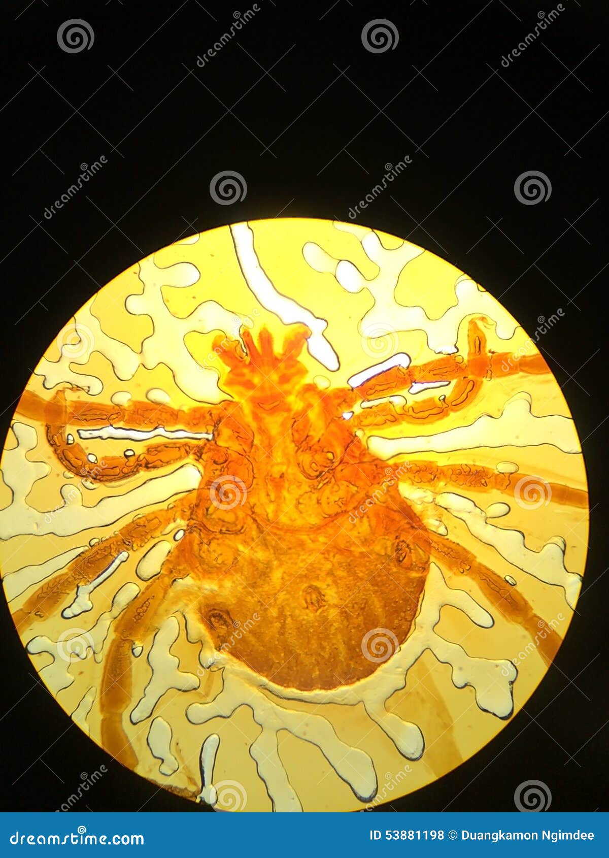 Microscope - Tick (Rhipicephalus Sanguineus) Stock Photo ...