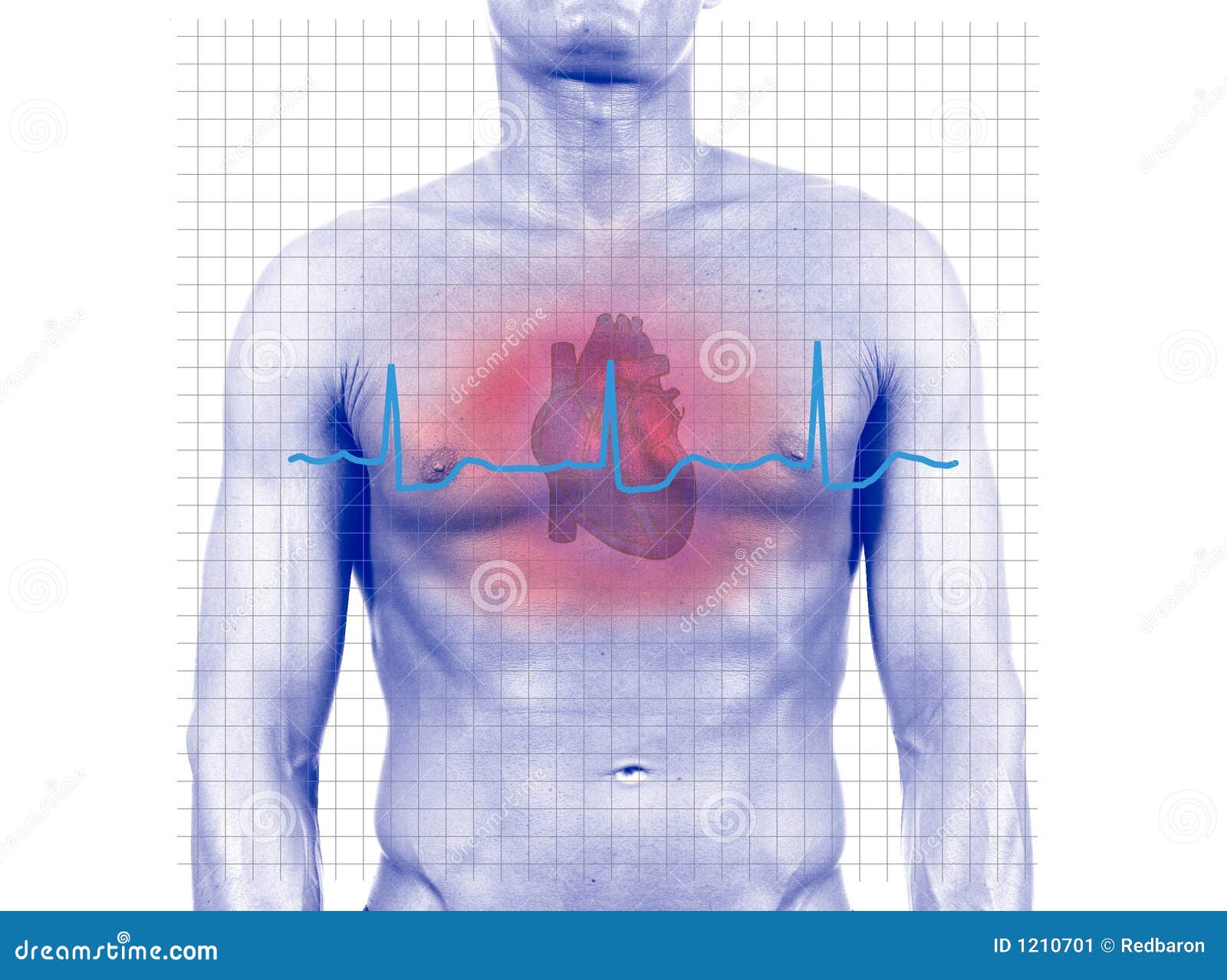 Hartaanval stock afbeelding. Image of affectie, behandeling - 1210701
