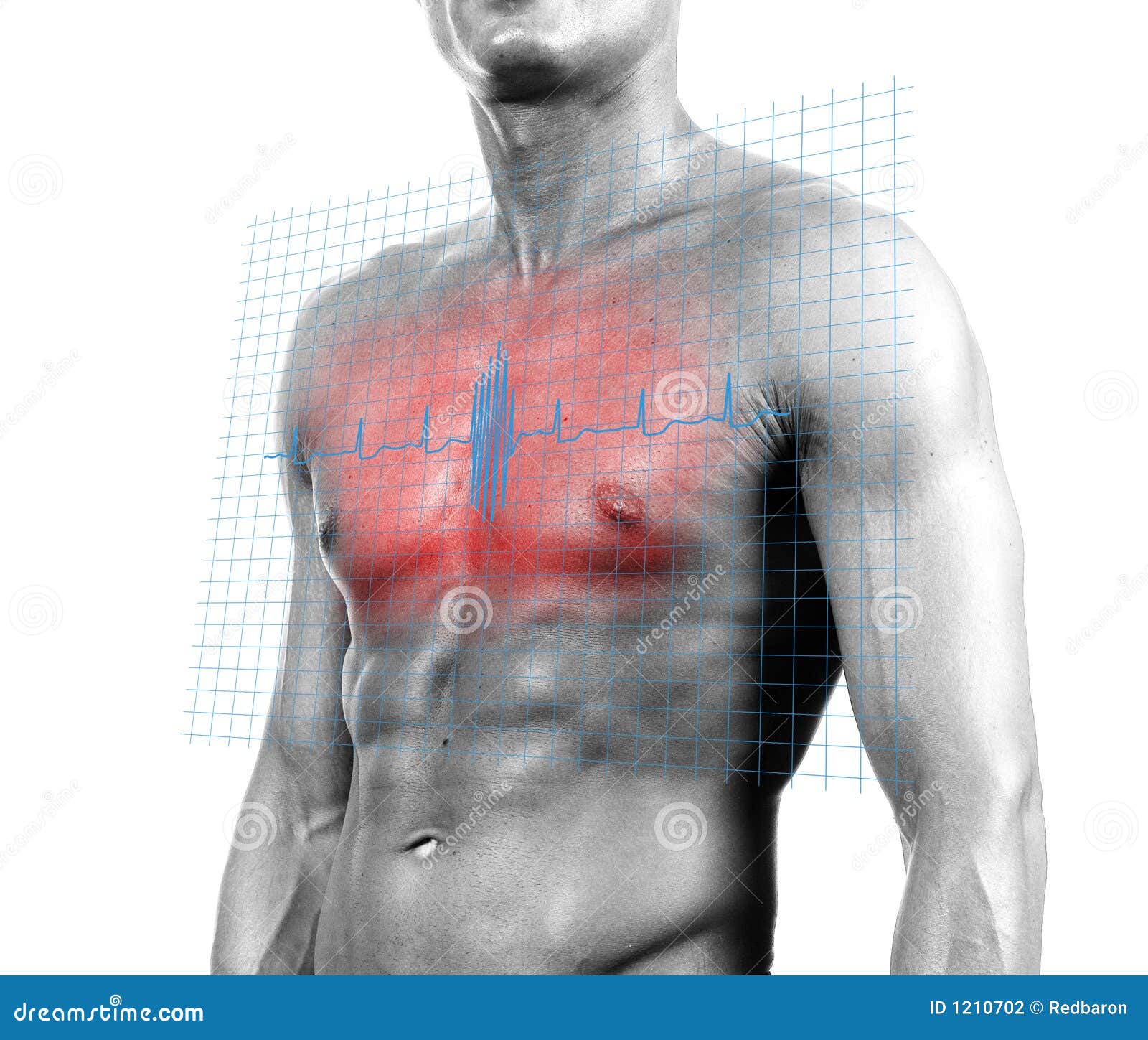 Hartaanval stock foto. Image of heel, hartstocht, nood - 1210702