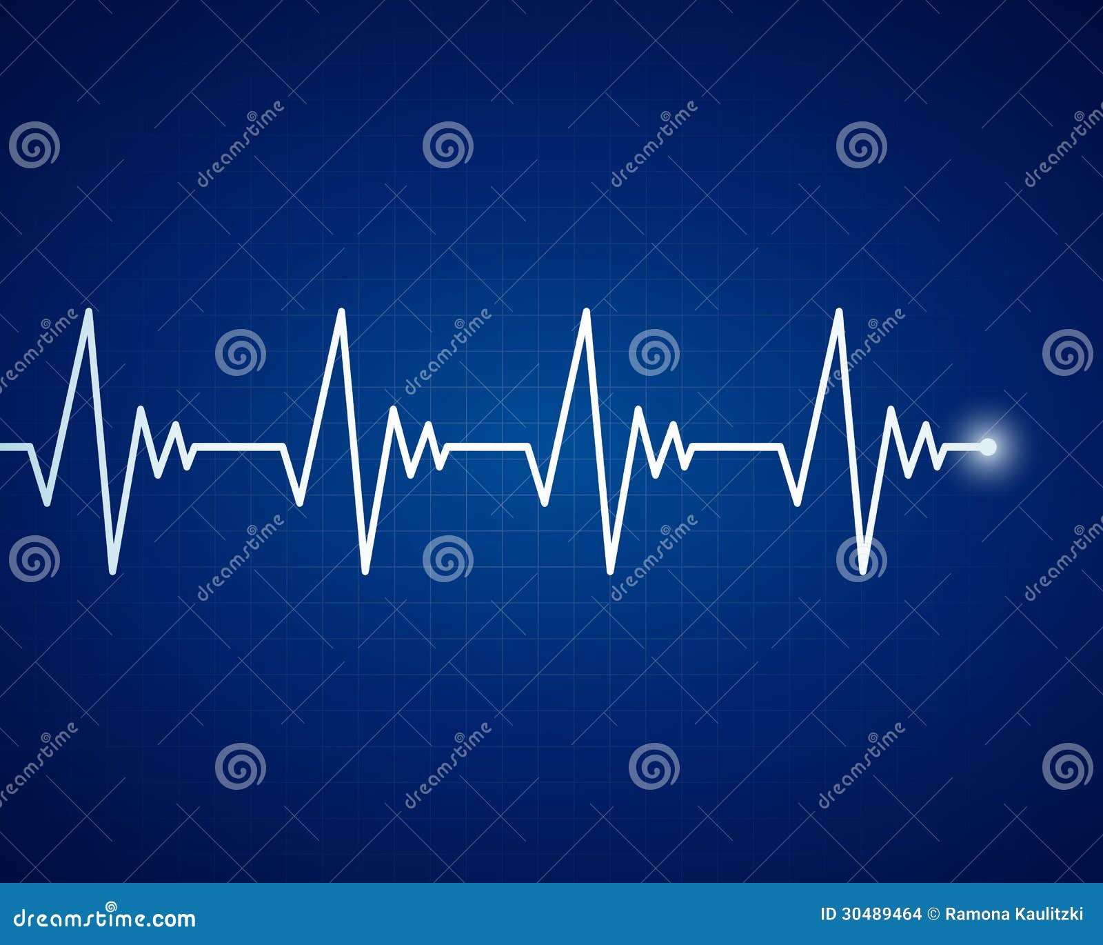 Hartfrequentie stock illustratie. Illustration of examen - 30489464