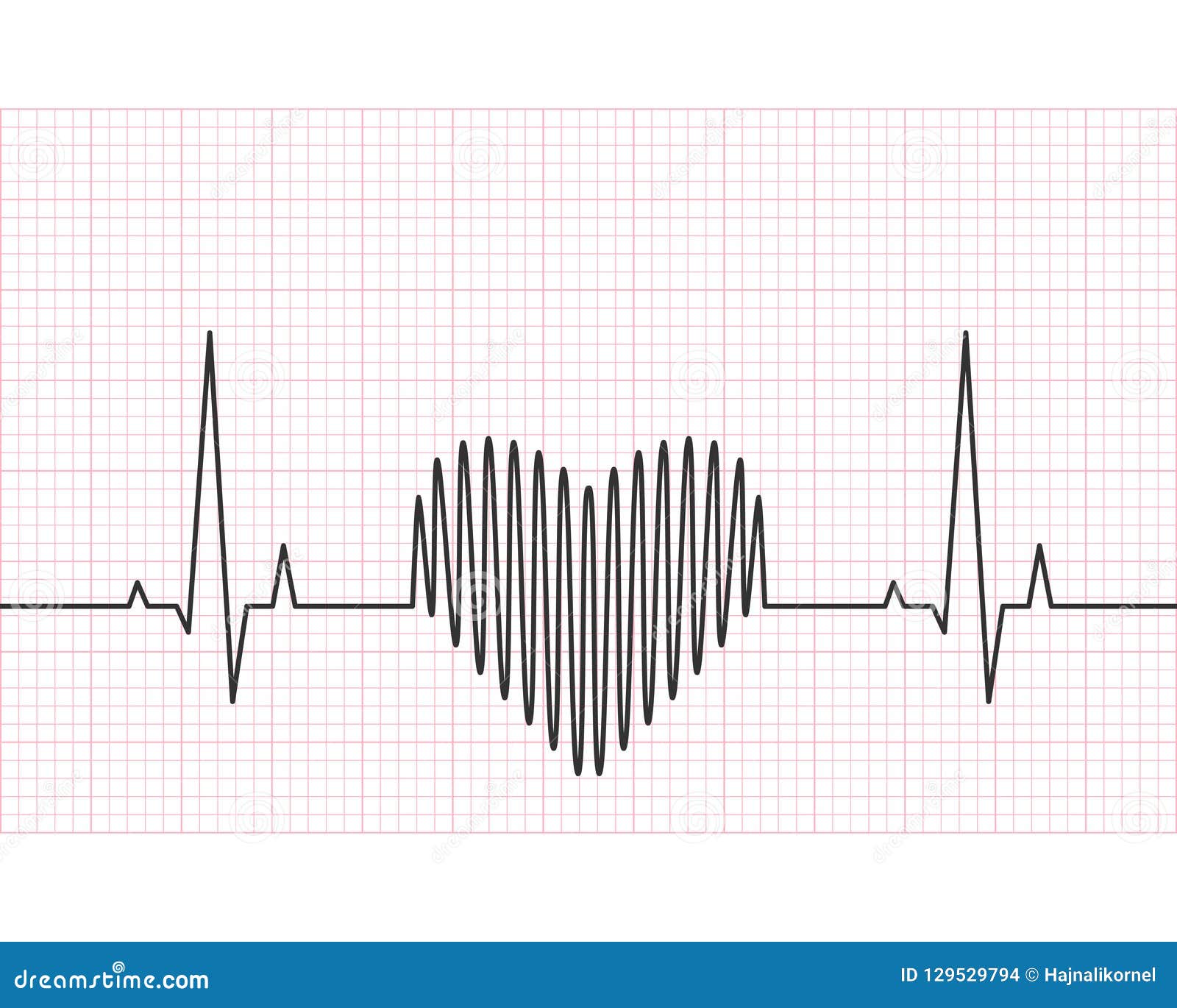 Hartslag, Elektrocardiogram En ECG-concept Vector Illustratie ...