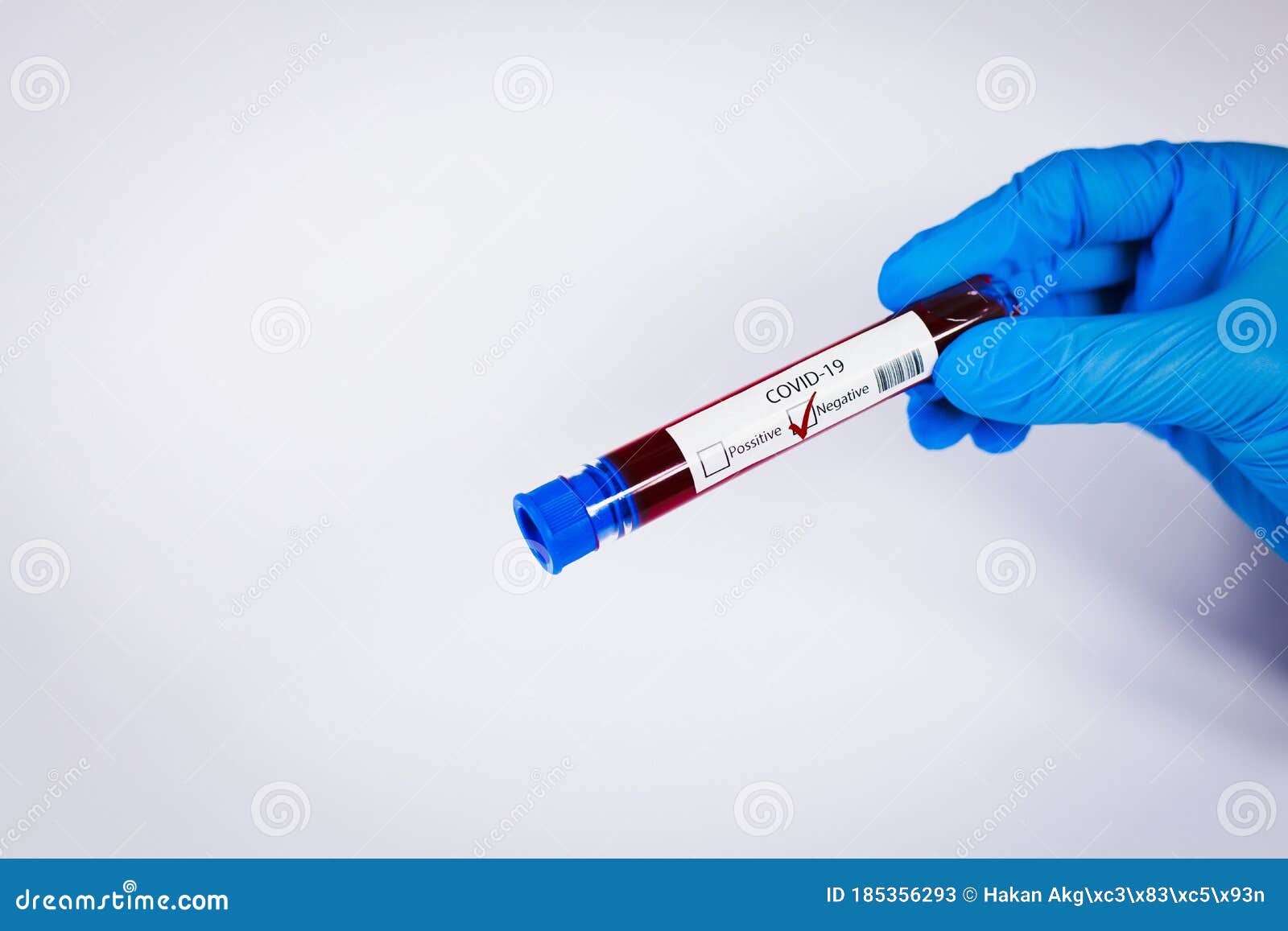 Blood Test Samples for Presence of Coronavirus COVID-19 Tube Containing ...