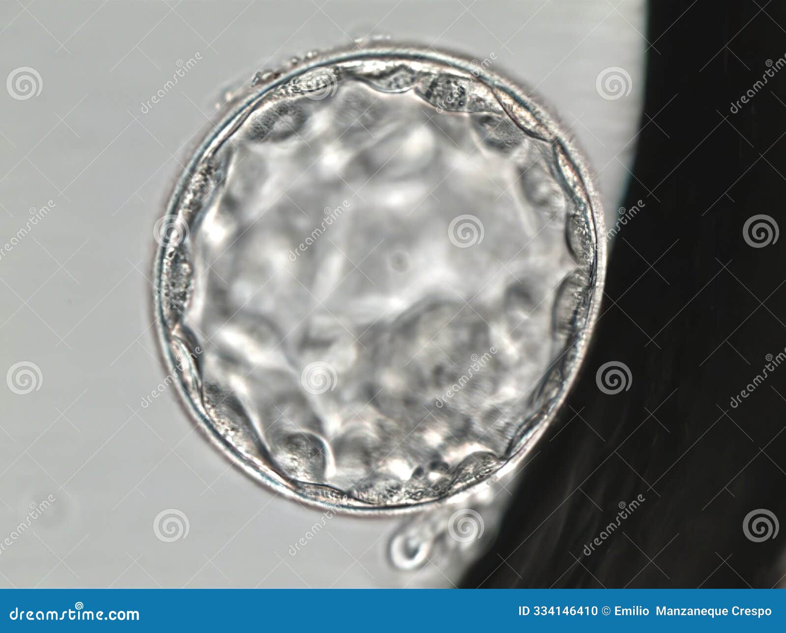 Hatched Human Blastocyst. Grade AA. on the Fifth Day of Development ...