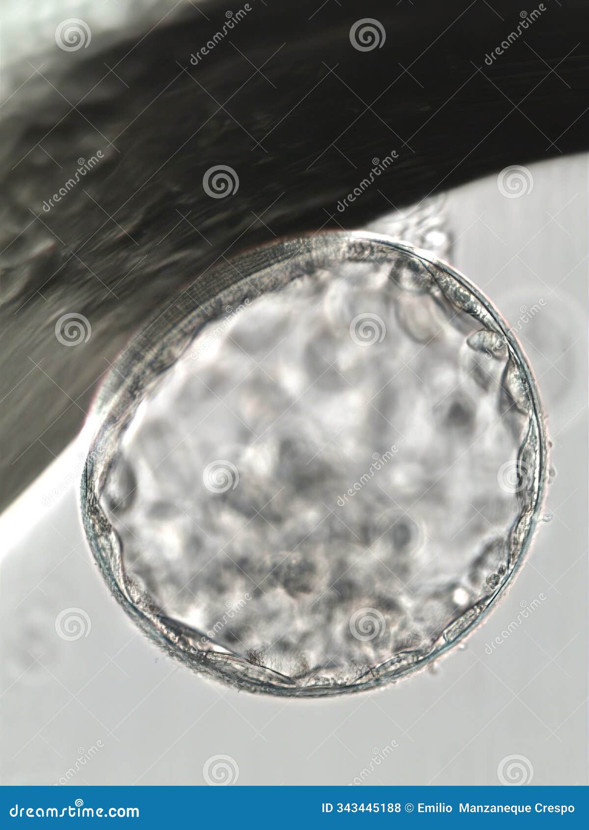 Hatched Human Blastocyst. Grade BA. on the Fifth Day of Development ...