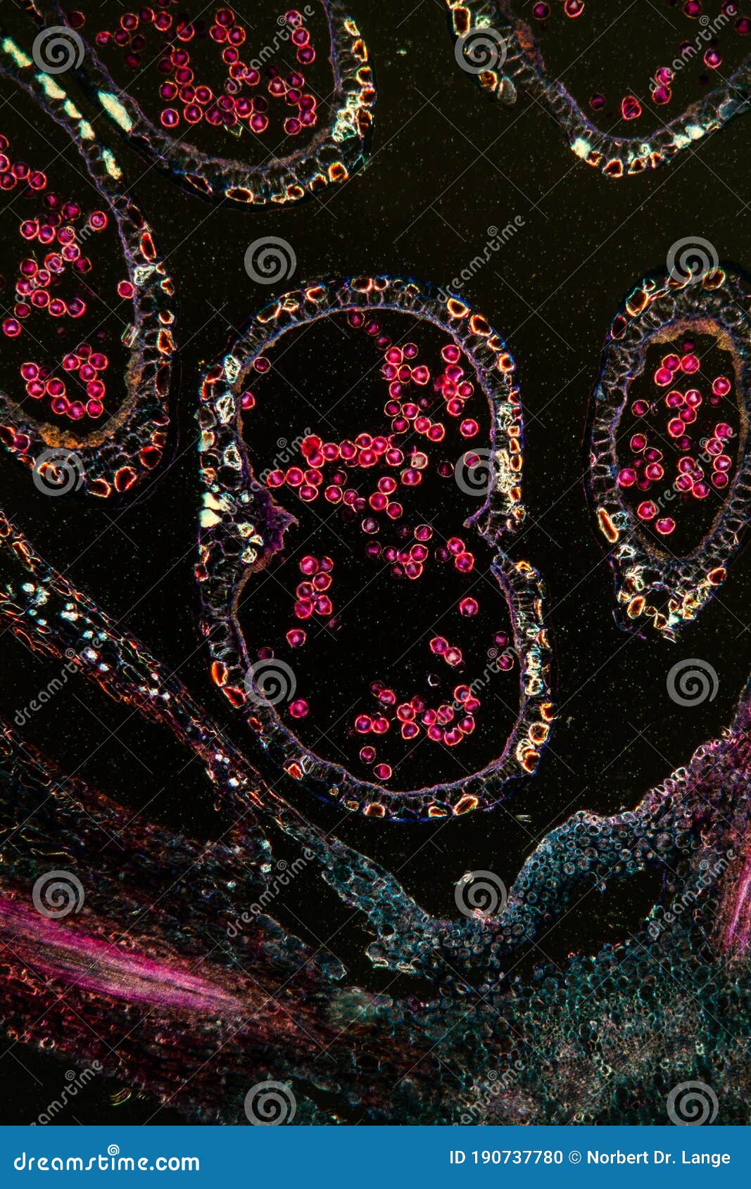 Dark Field Microscopy Bacteria