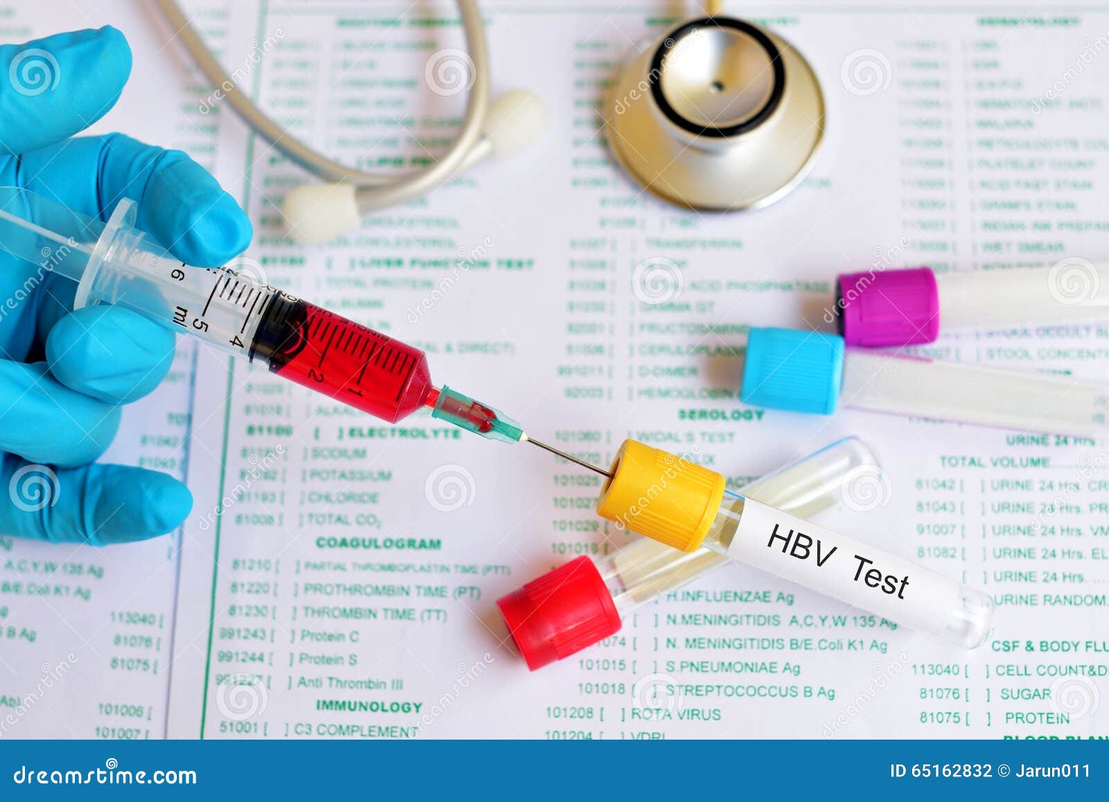 HBV test stock photo. Image of chemistry, checkup, biology - 65162832