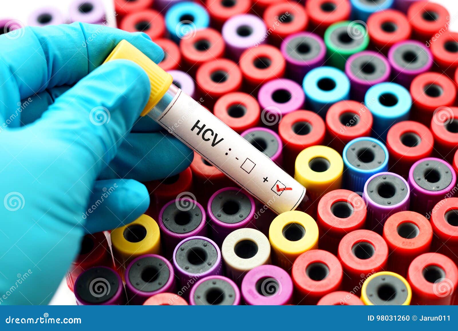 HCV positive stock photo. Image of jaundice, bank, laboratory - 98031260