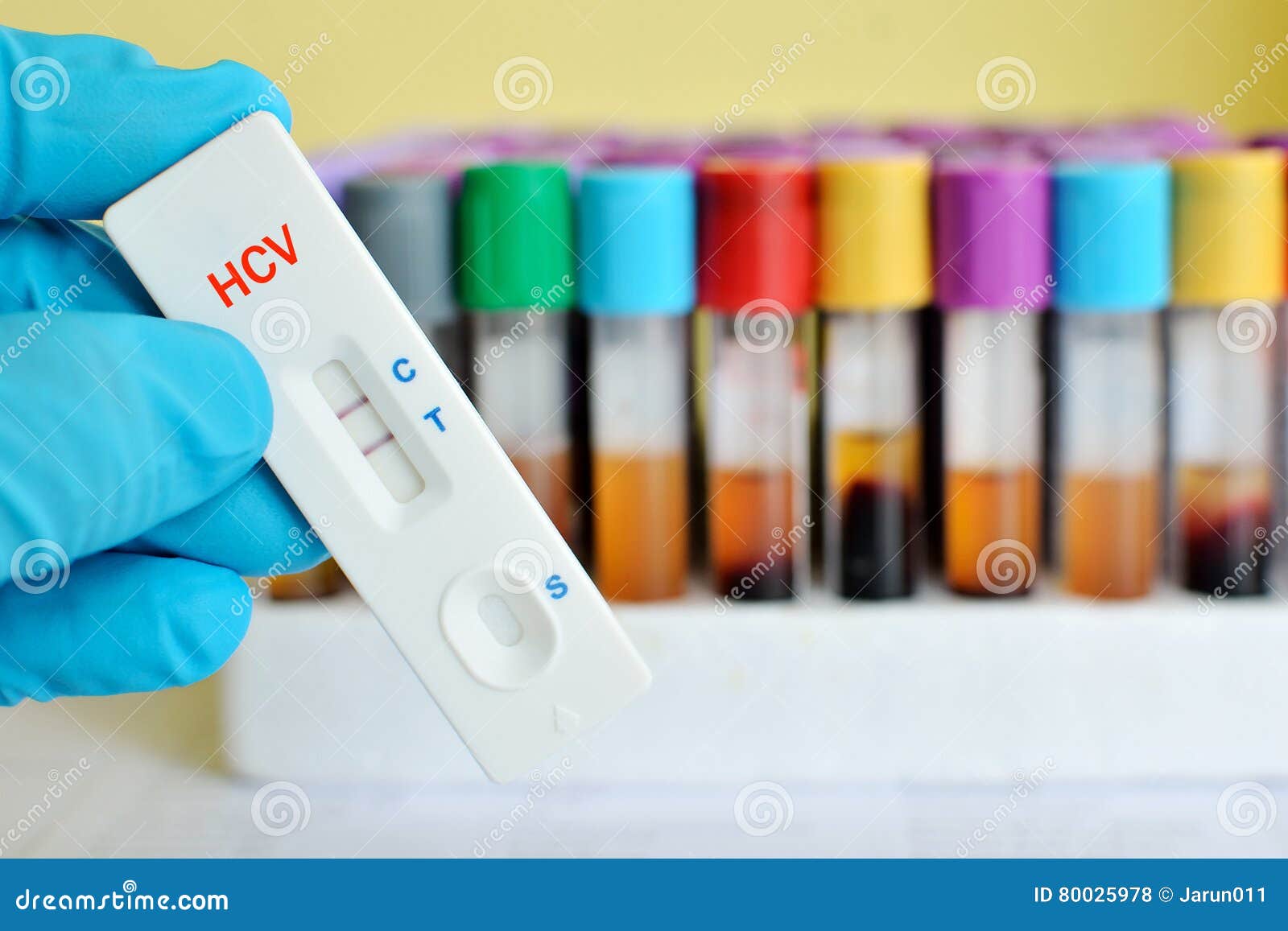 HCV positive stock photo. Image of hospital, research - 80025978