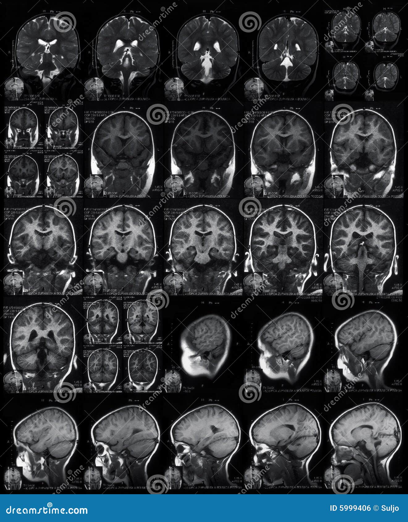 Head MRI Scan From Different Angles Stock Photography | CartoonDealer ...