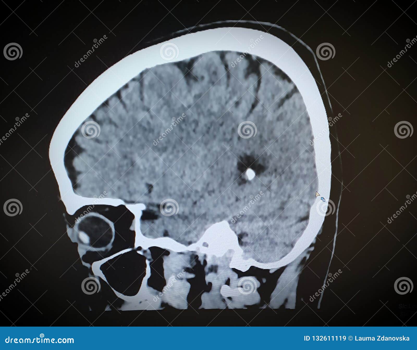 Head CT scan stock image. Image of side, native, medicine - 132611119