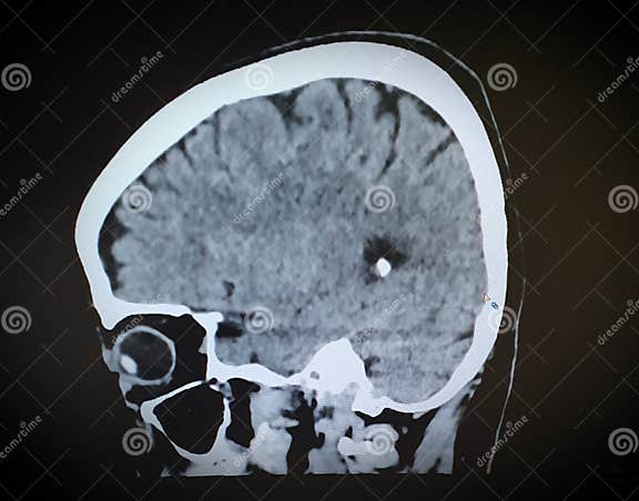 Head CT scan stock image. Image of side, native, medicine - 132611119