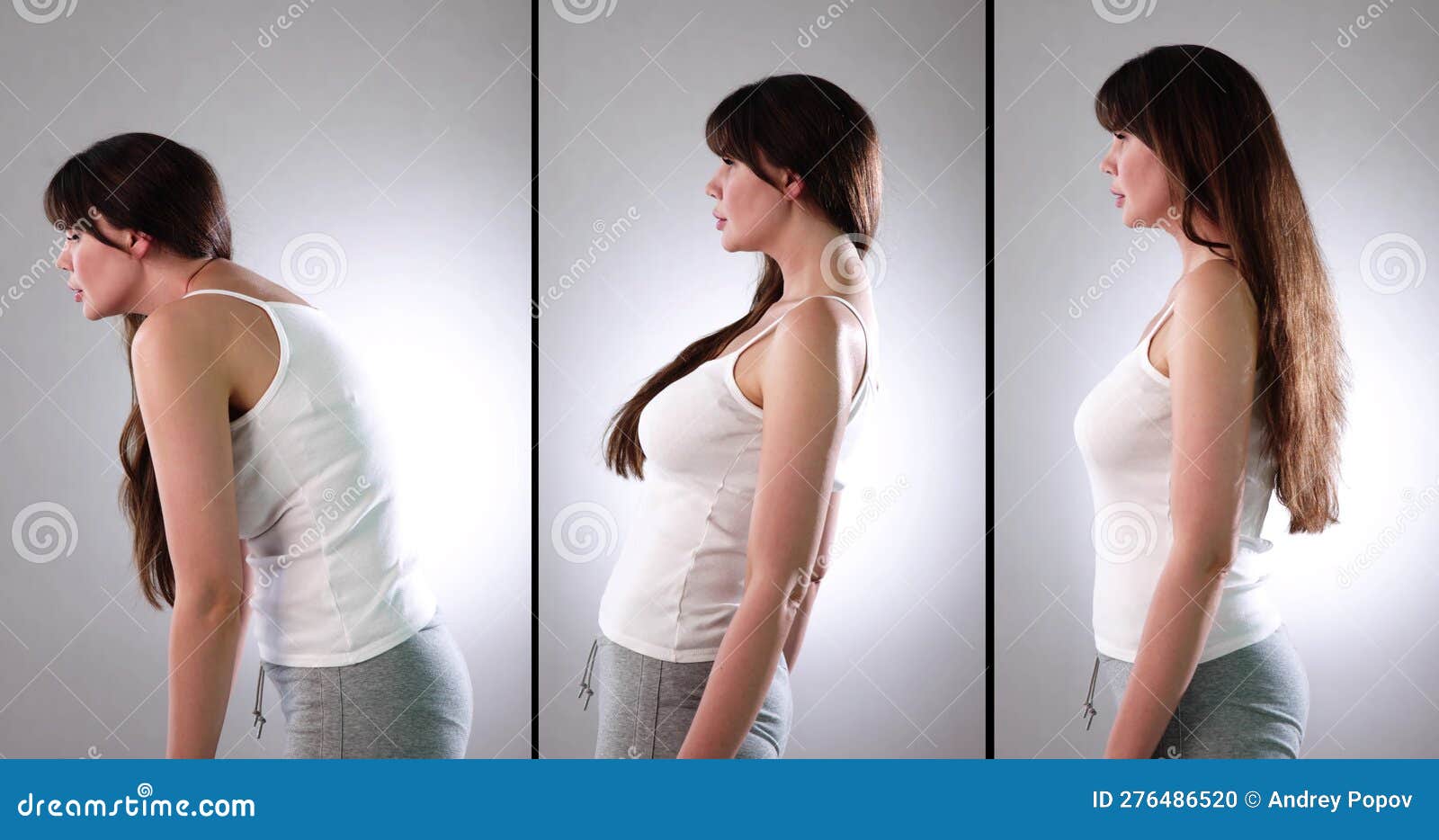 Head Forward Posture, Lordosis, Kyphosis Stock Photo - Image of ...