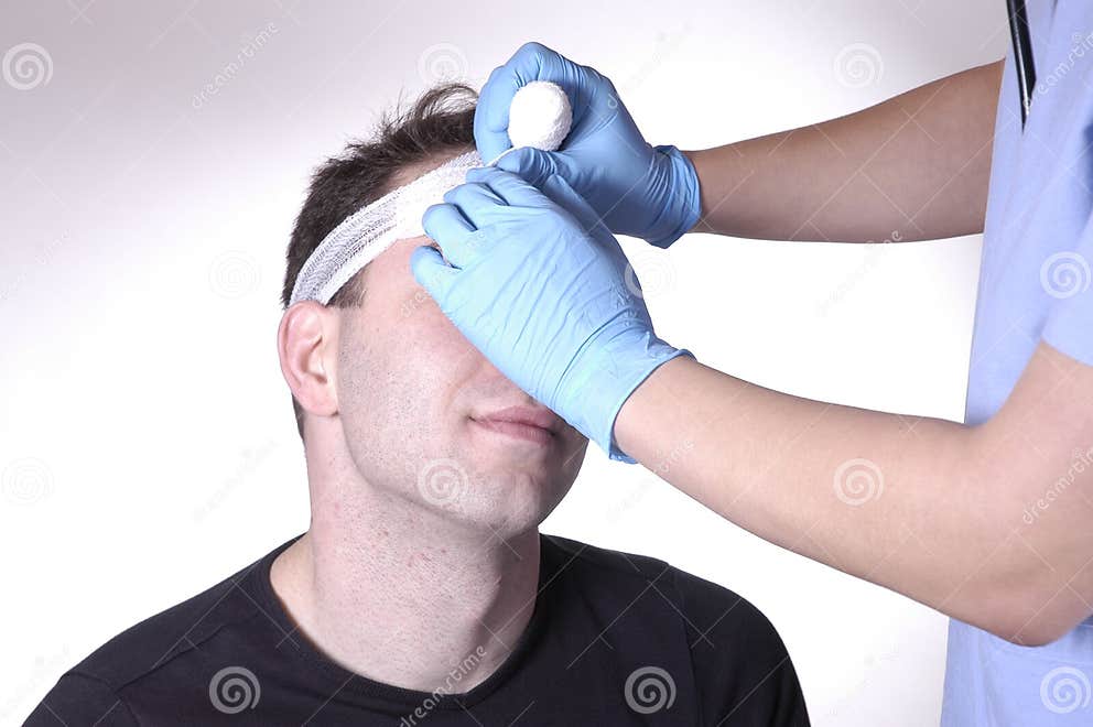 Head injury stock image. Image of physician, illness, health - 270807