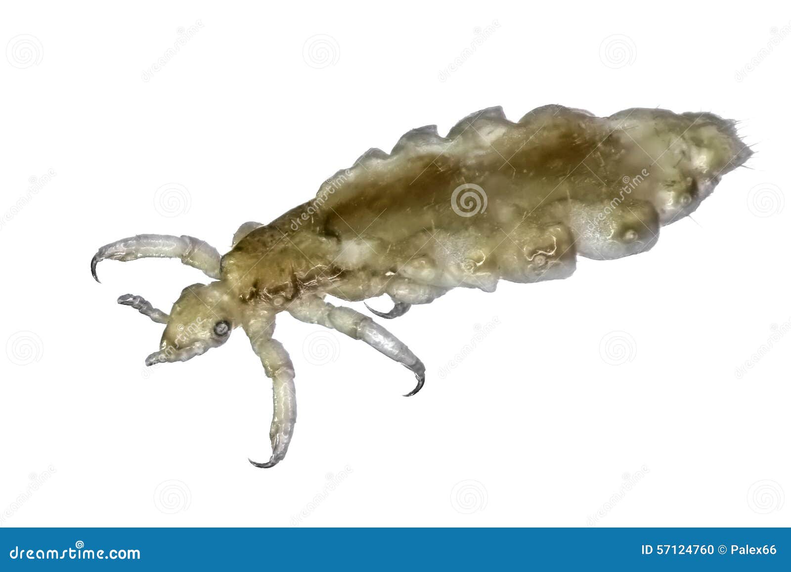 Two Head Lice (Pediculus Humanus Capitis) On A White Surface, Next To A ...