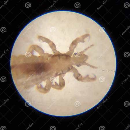 Head lice under microscope stock photo. Image of organ - 183026194