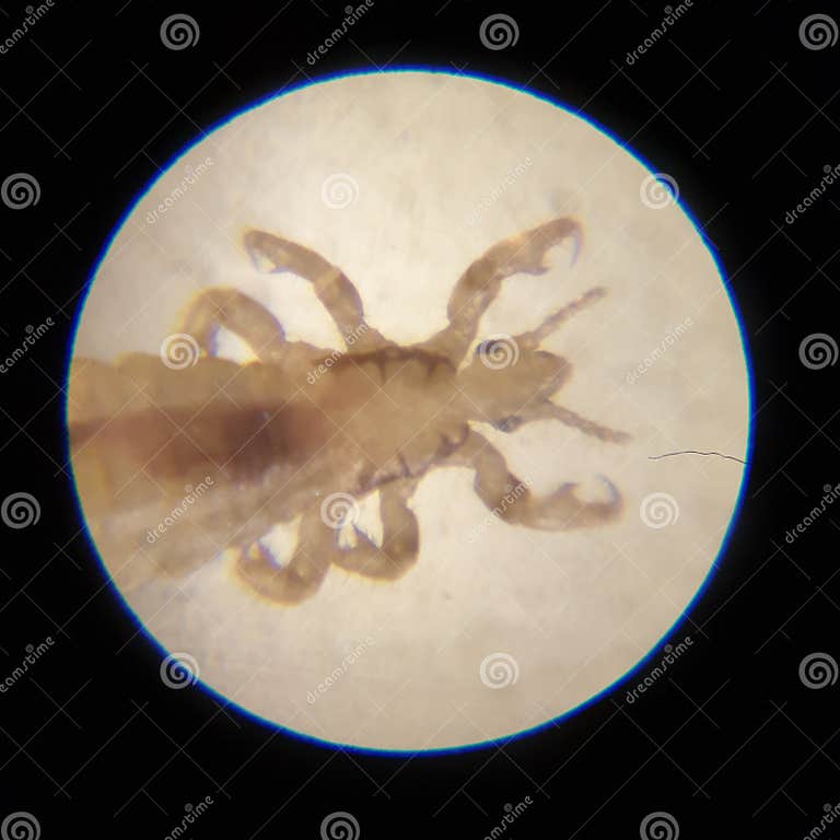 Head lice under microscope stock photo. Image of organ - 183026194