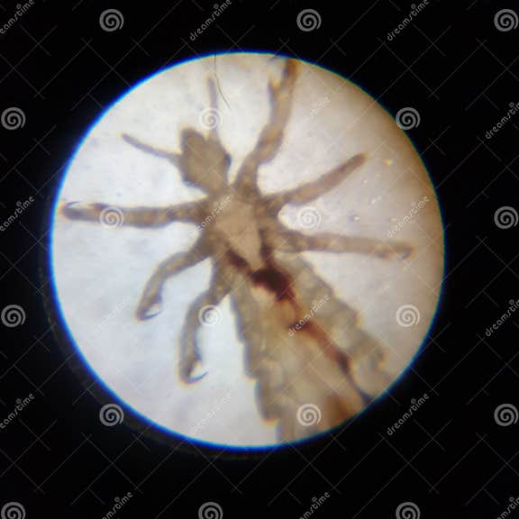 Head lice under microscope stock photo. Image of microscope - 183029926