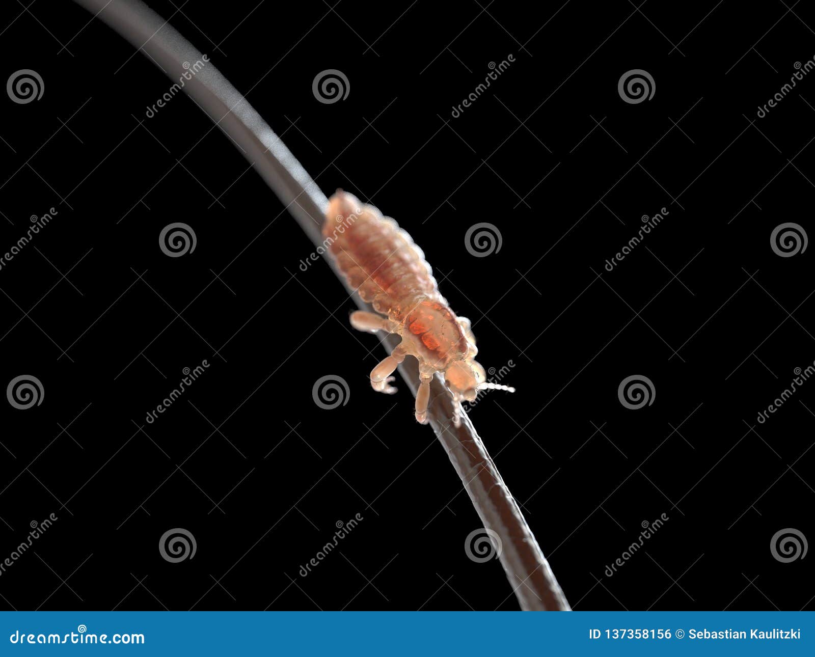 A head louse stock illustration. Illustration of contagious - 137358156