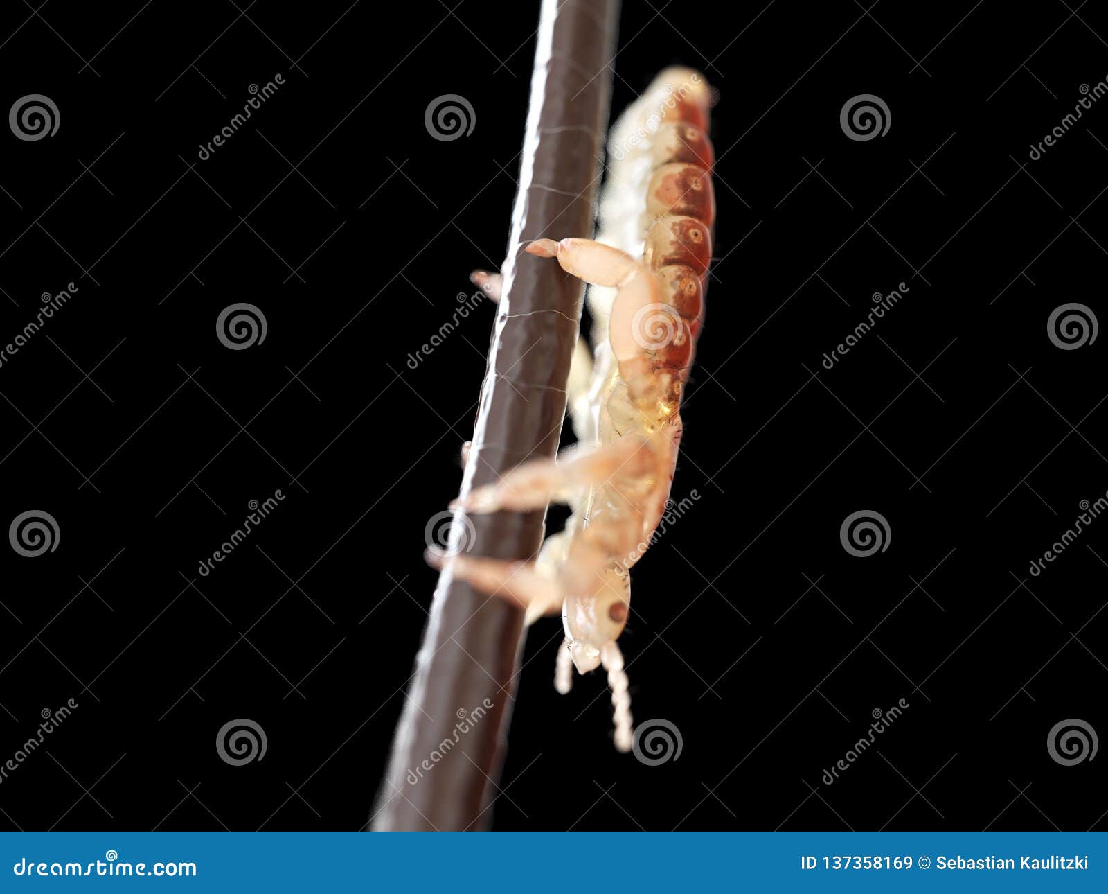 A head louse stock illustration. Illustration of graphic - 137358169