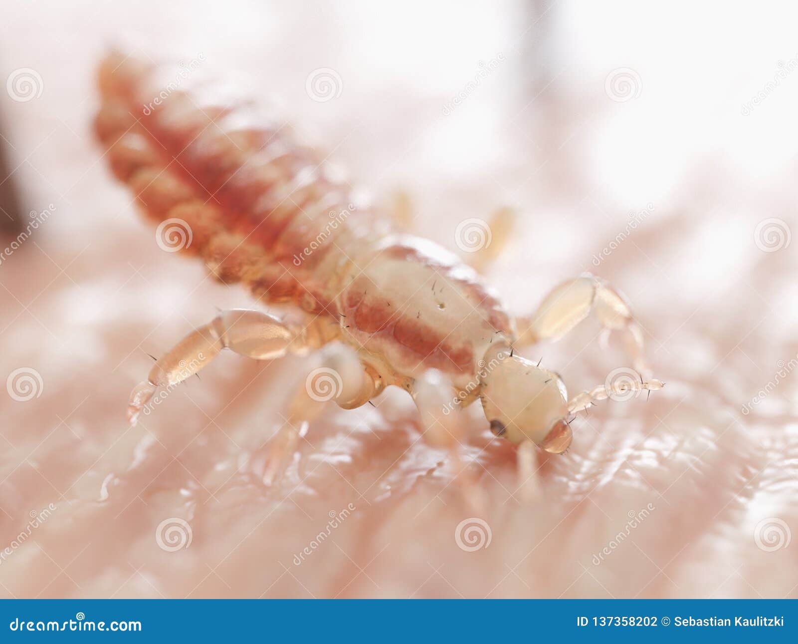 Louse Egg Royalty-Free Stock Photography | CartoonDealer.com #82338131