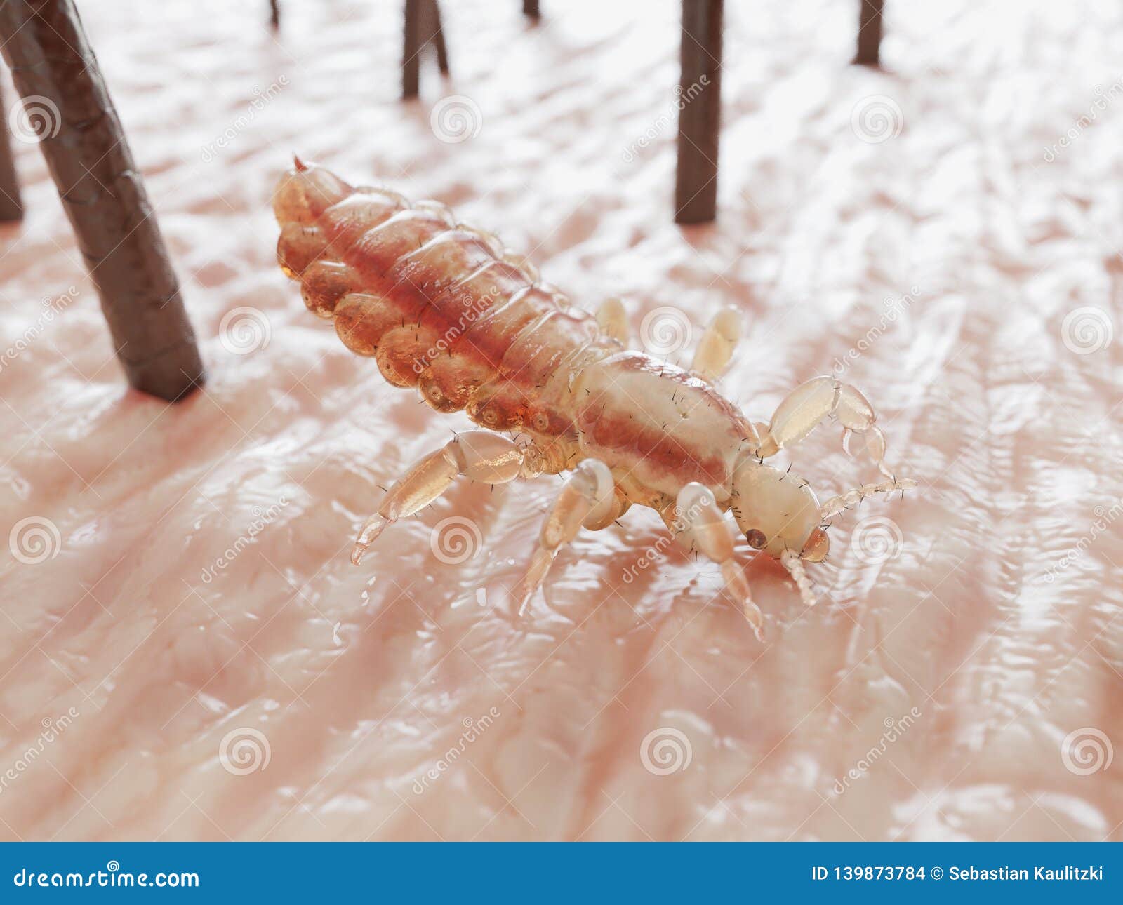 A head louse stock illustration. Illustration of hair - 139873784