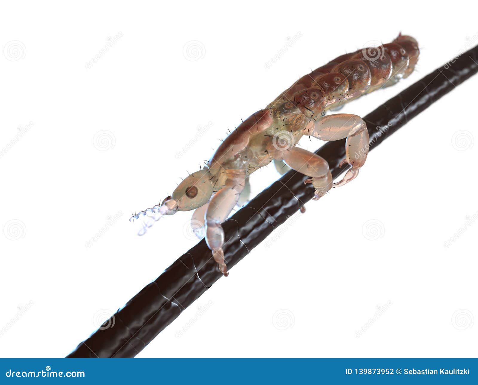 Louse Egg Royalty-Free Stock Photography | CartoonDealer.com #82338131