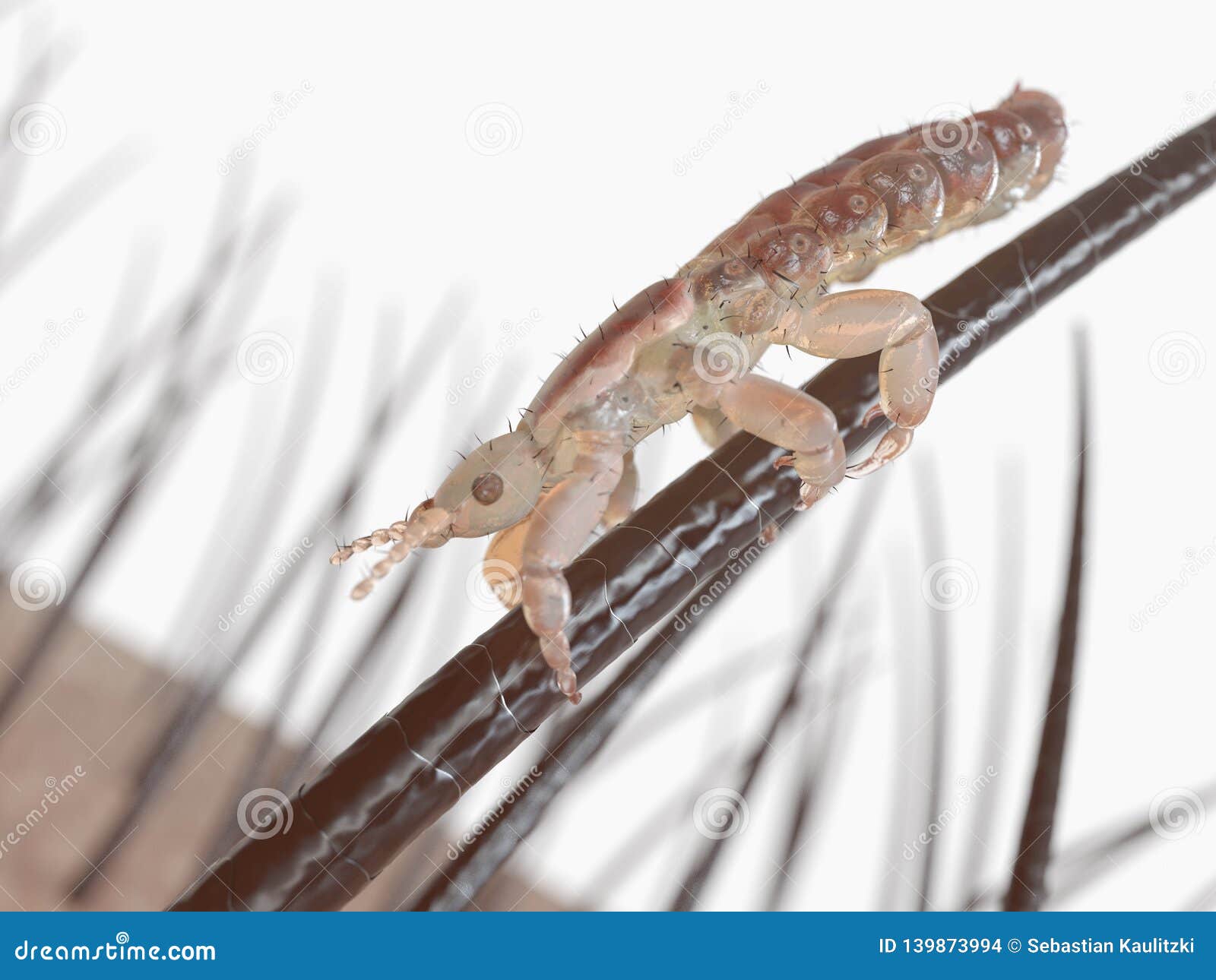 Head Louse Life Cycle Stock Photo | CartoonDealer.com #46581414