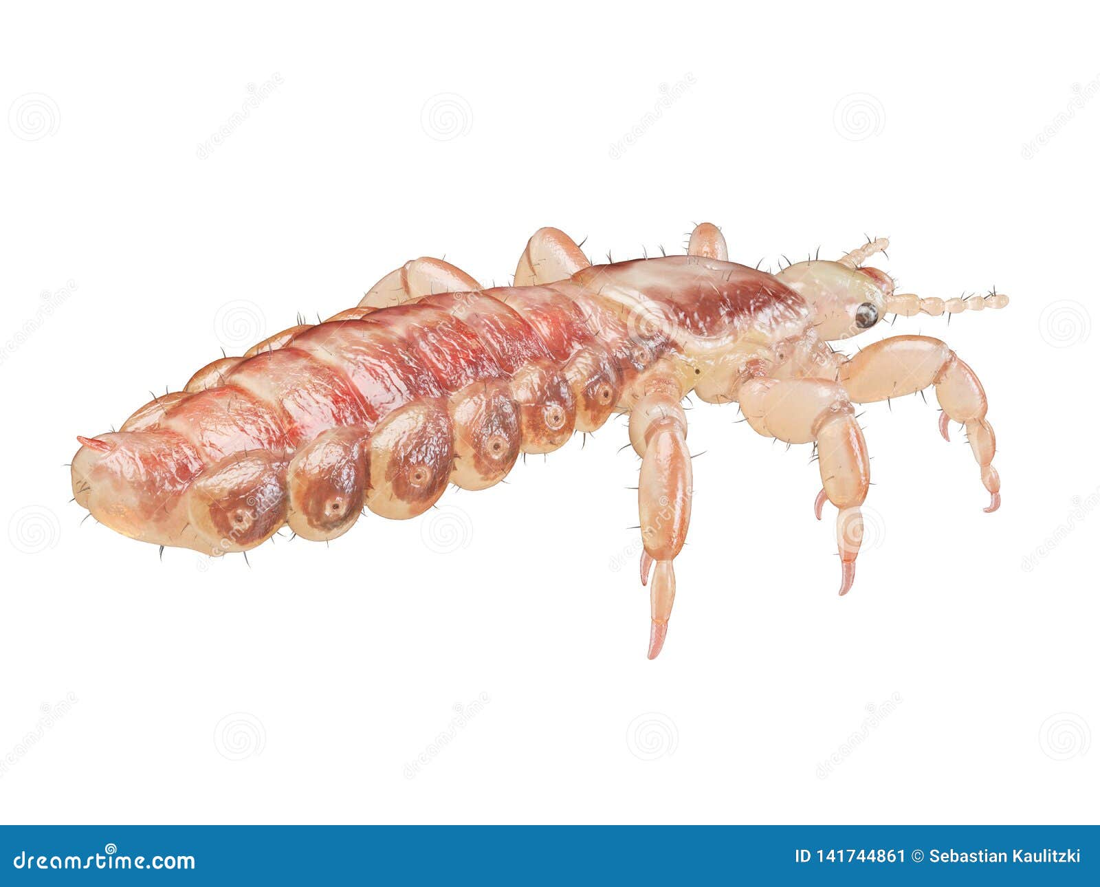 A head louse stock illustration. Illustration of hygiene - 141744861