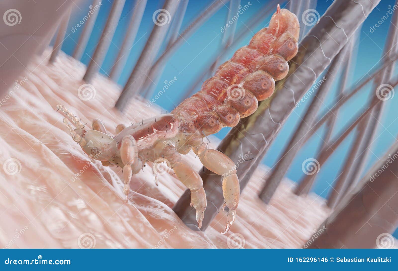 A head louse stock illustration. Illustration of fauna - 162296146