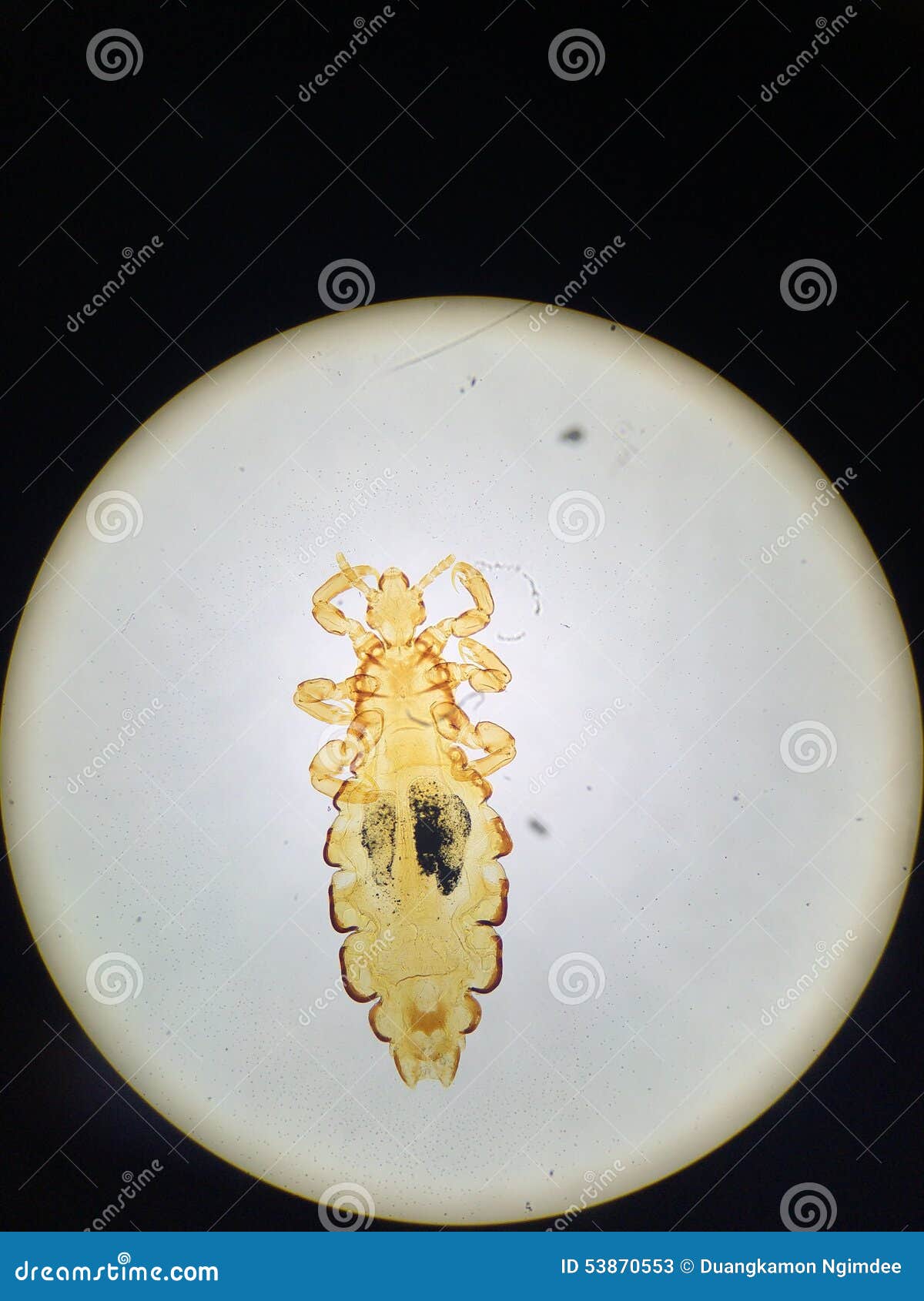 Head louse editorial stock photo. Image of microscope - 53870553