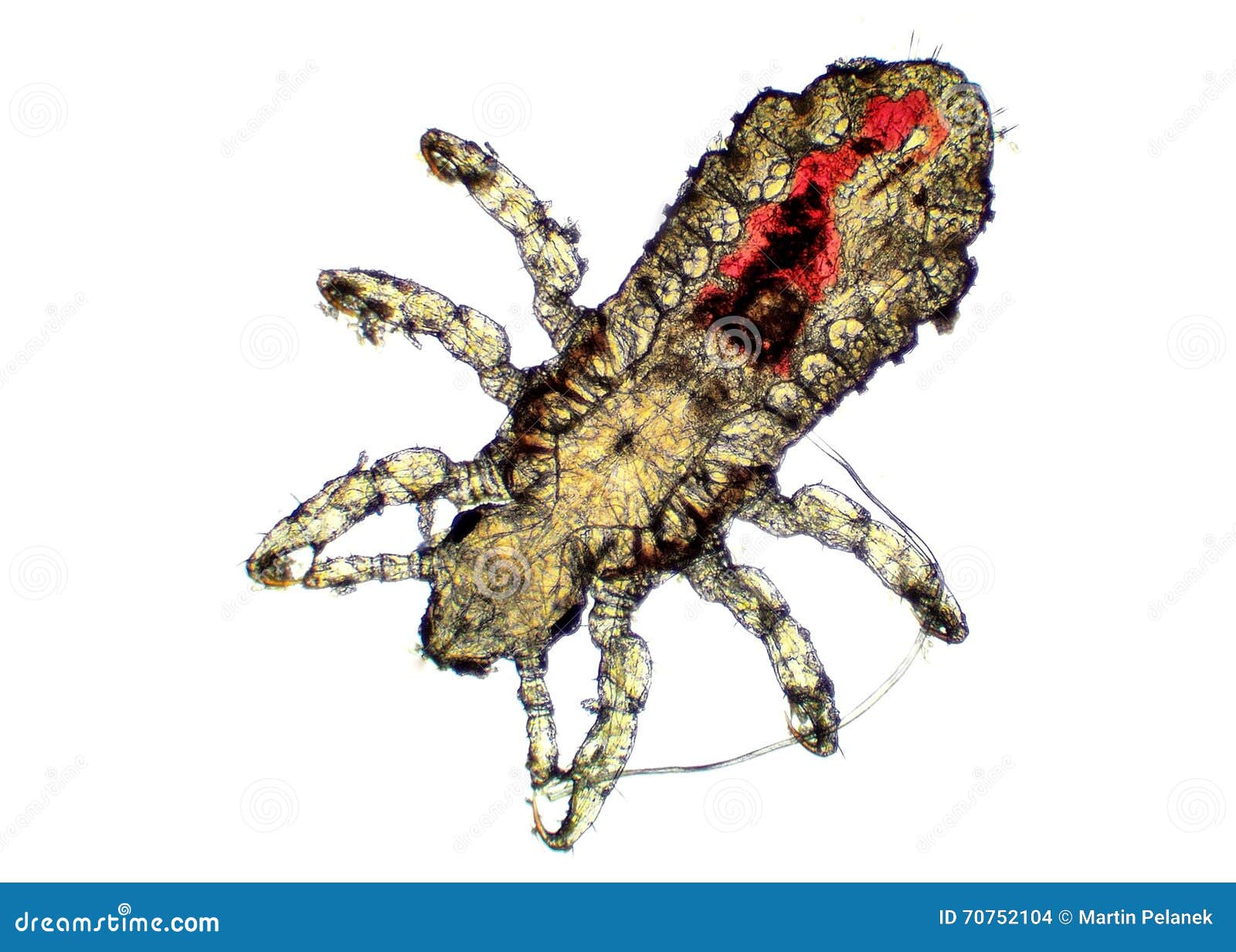 Head Louse - Pediculus Capitis, Microscope Picture Stock Photo - Image ...