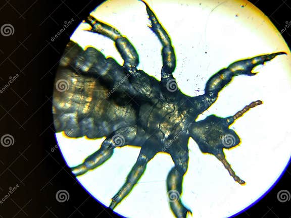 The Head Louse (Pediculus Humanus Capitis) Stock Image - Image of ...