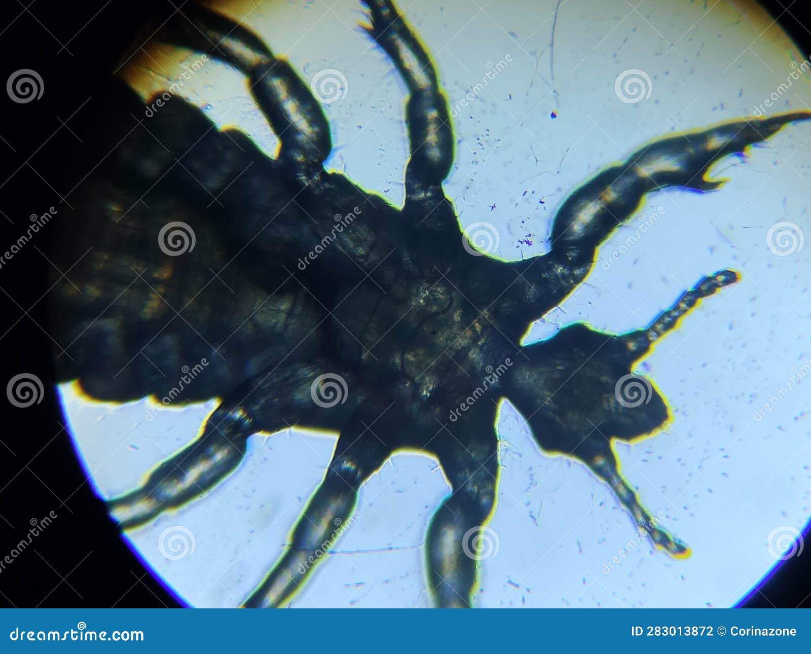 The Head Louse (Pediculus Humanus Capitis) Stock Photo - Image of ...