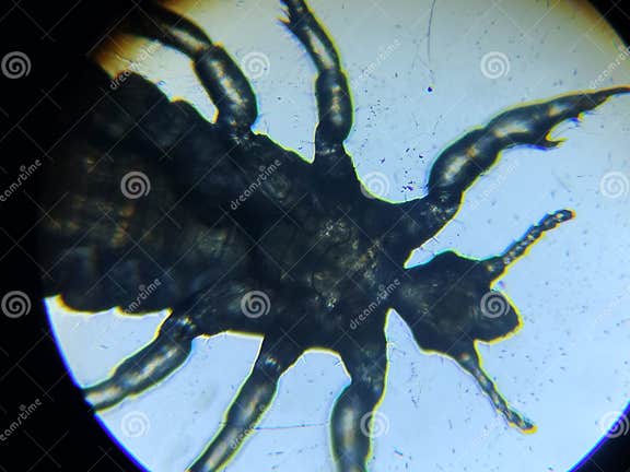 The Head Louse (Pediculus Humanus Capitis) Stock Photo - Image of ...
