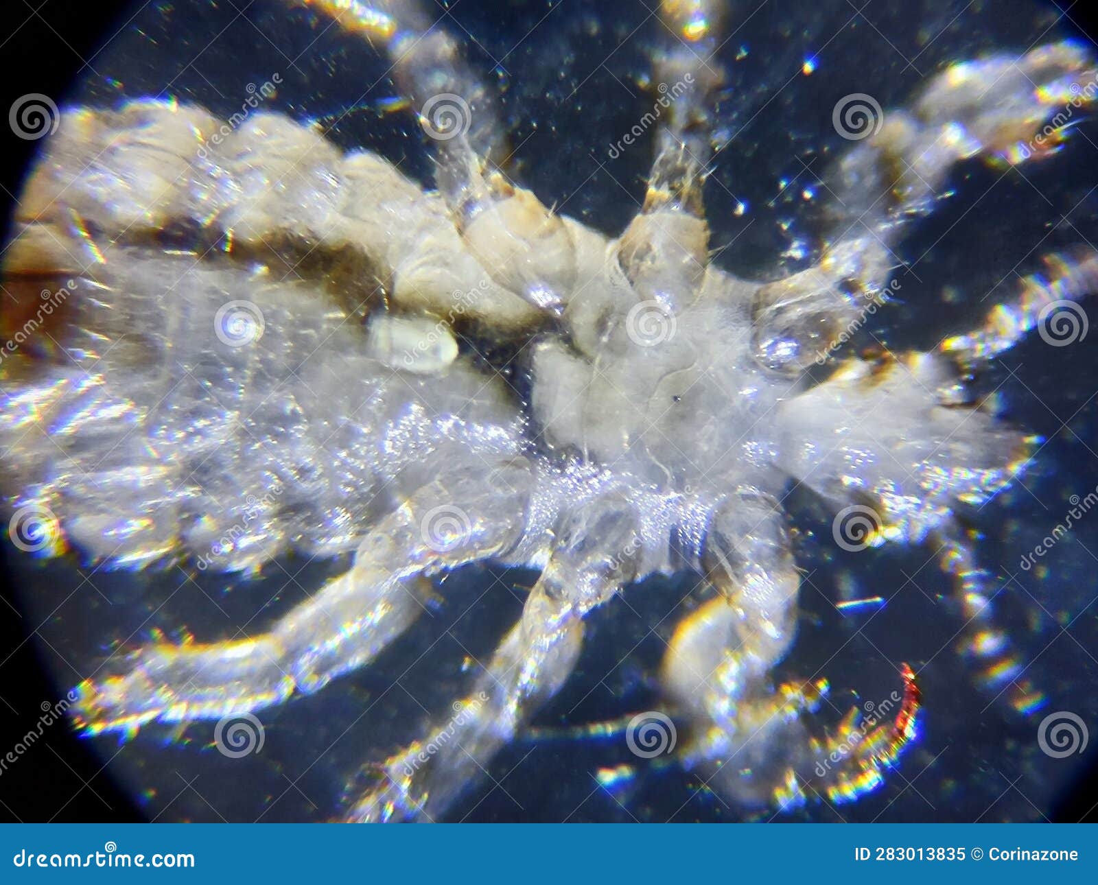 The Head Louse (Pediculus Humanus Capitis) Stock Image - Image of ...