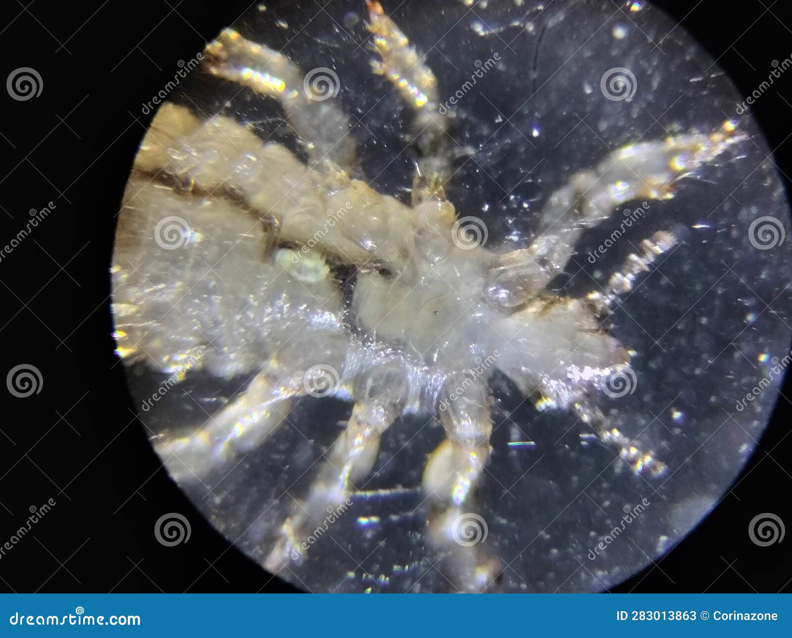 The Head Louse (Pediculus Humanus Capitis) Stock Image - Image of ...